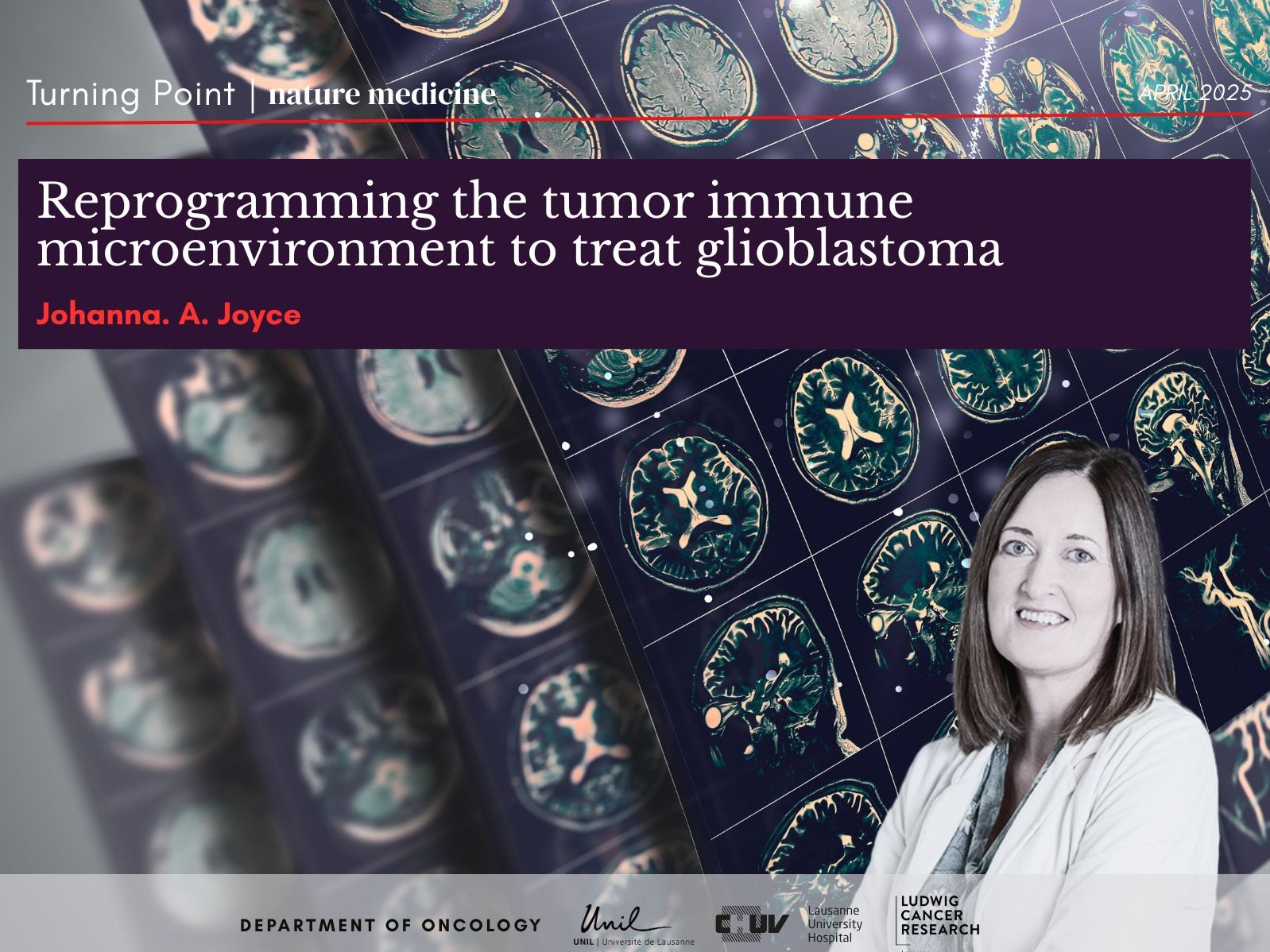 Reprogramming the tumor microenvironment: a turning point in brain ...